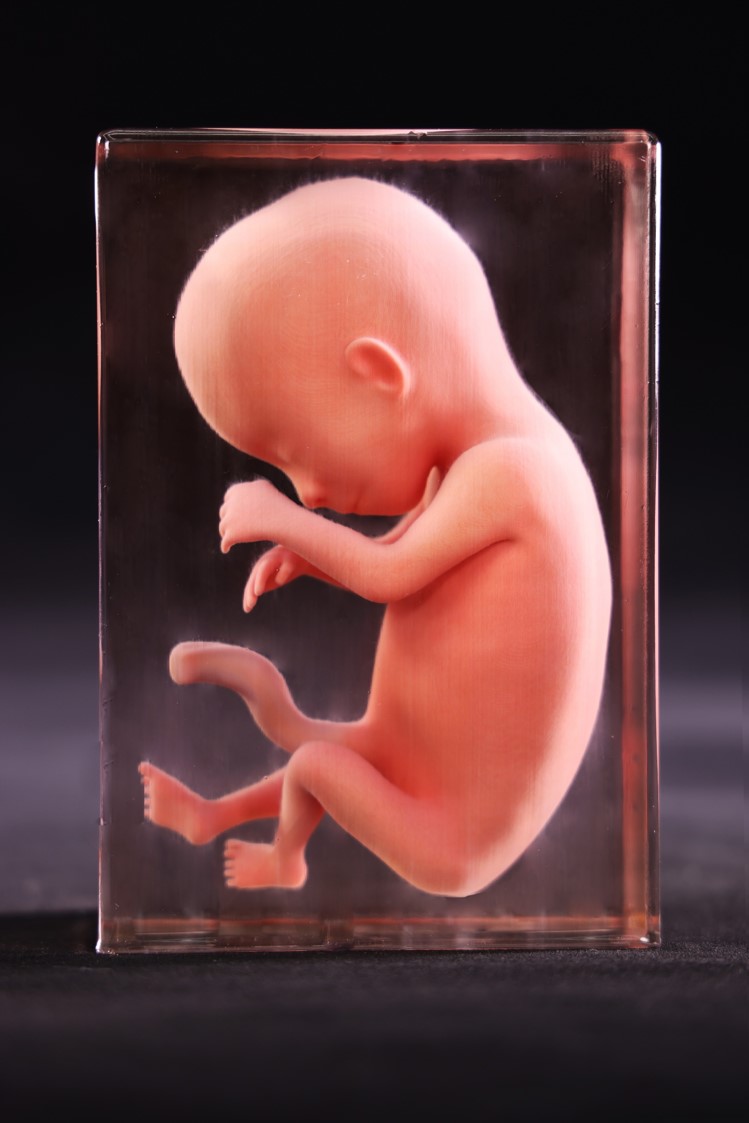 Digihuman 3D Printing Model-General Embryo - Shandong Digihuman ...