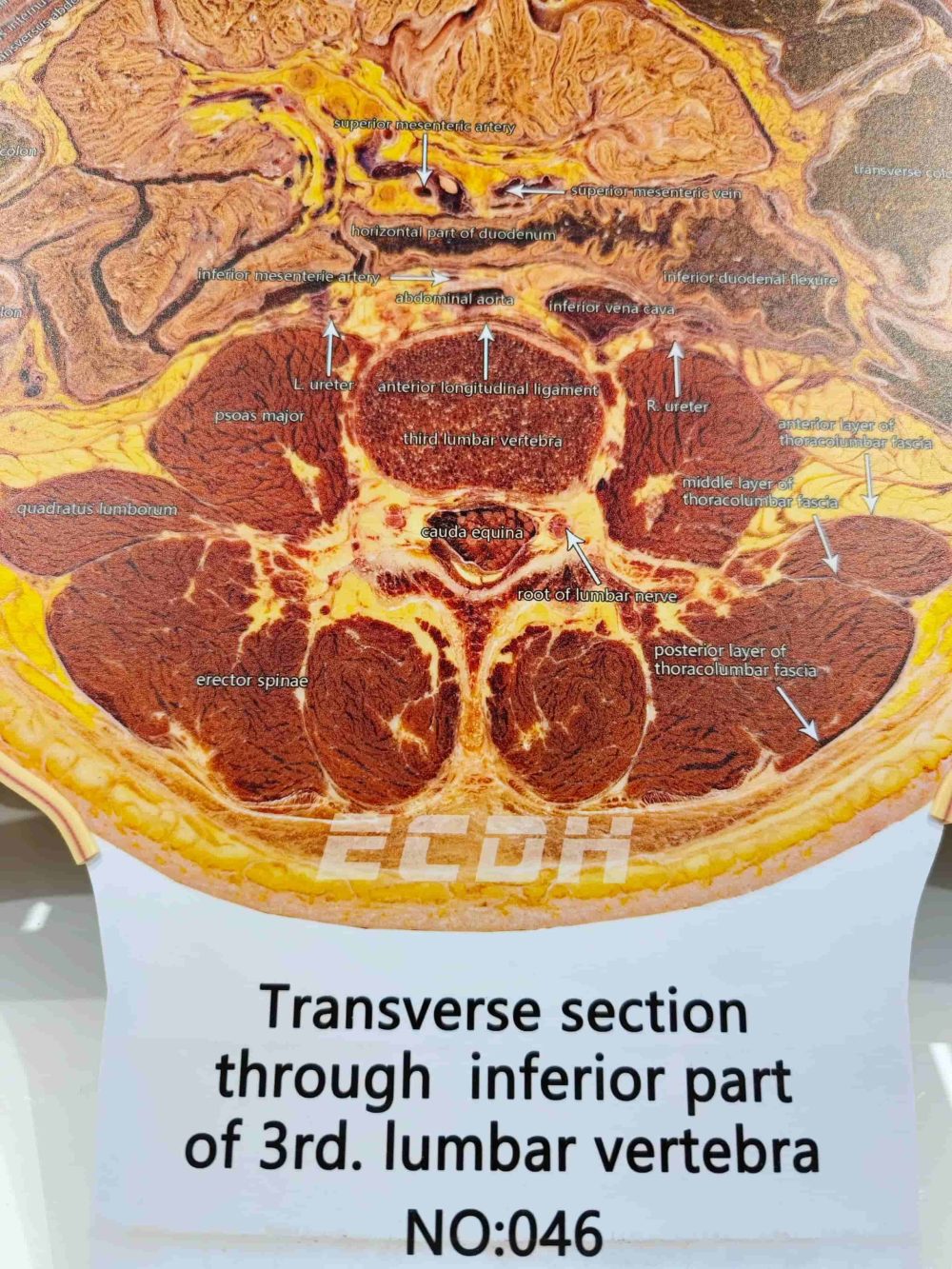 Digihuman HD Tomography 3D Printing Model - Shandong Digihuman ...